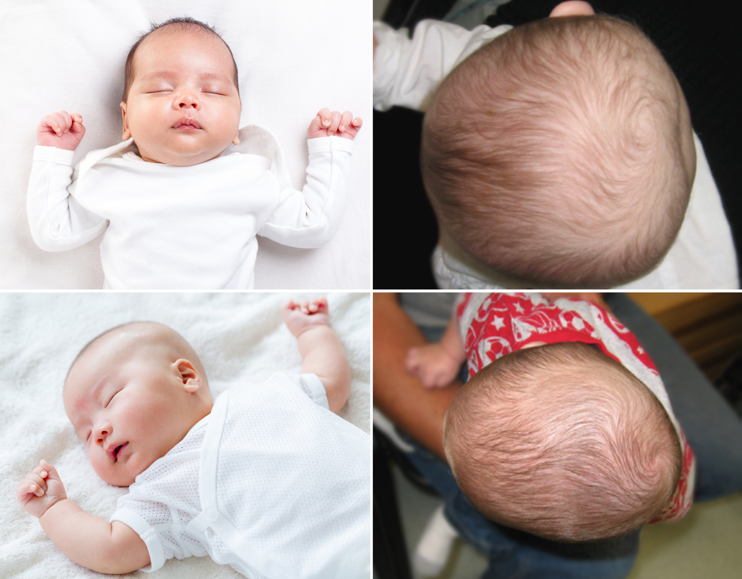 Preventing Baby Flat Head – Health Information